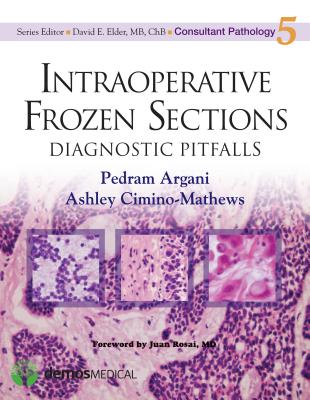 【楽天市場】Intraoperative Frozen Sections: Diagnostic Pitfalls/DEMOS HEALTH ...